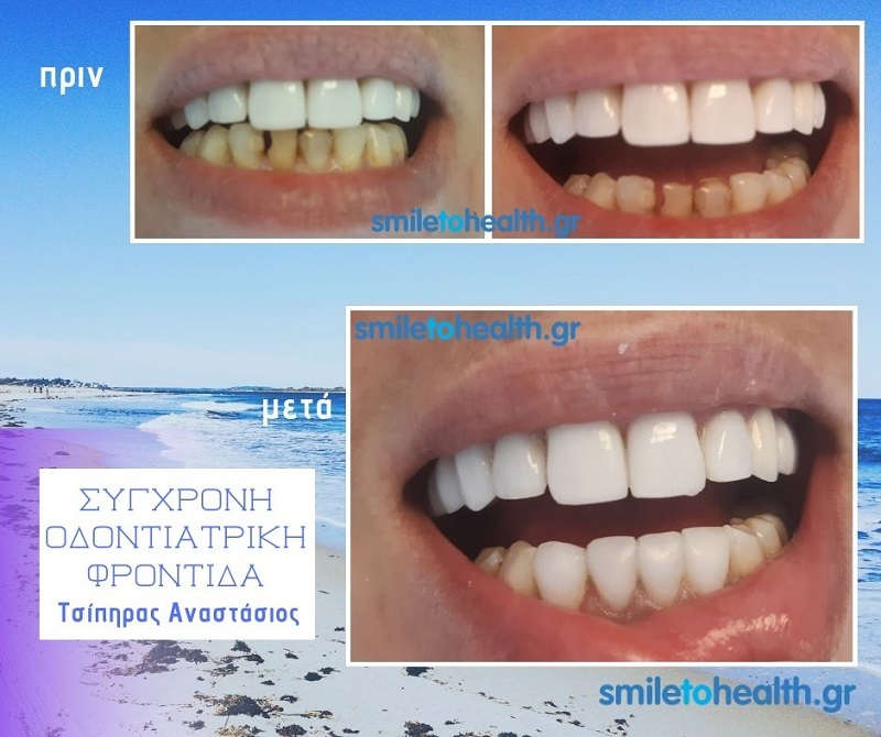 Τσίπηρας Αναστάσιος Οδοντίατρος | doctoranytime