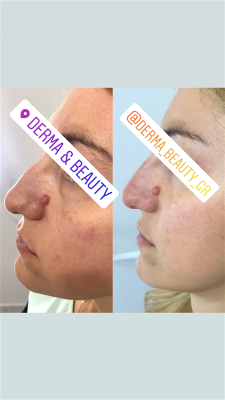 Derma & Beauty Δερματολόγος - Αφροδισιολόγος | doctoranytime