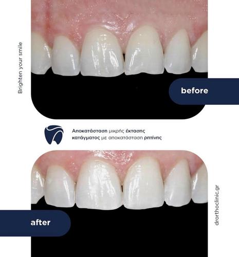 Οδοντιατρική-Ορθοδοντική Κλινική - Τσοπάκης Νίκος | Ταμιωλάκη Αλίνα Dr ...