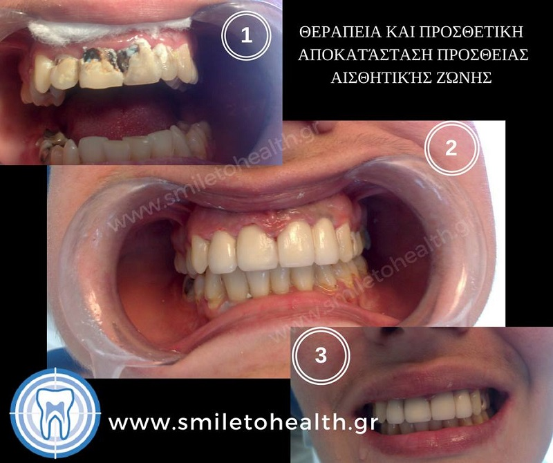 Τσίπηρας Αναστάσιος Οδοντίατρος | doctoranytime