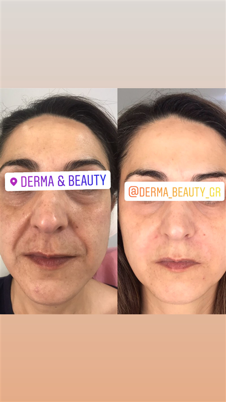 Derma & Beauty Δερματολόγος - Αφροδισιολόγος | doctoranytime