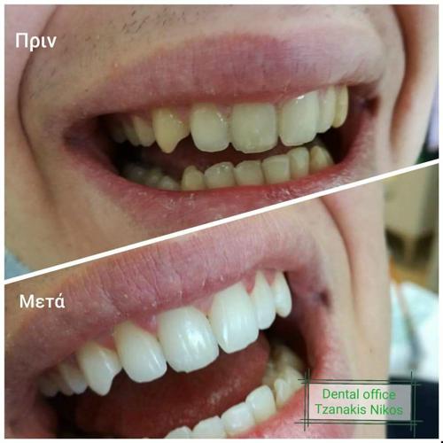 Οδοντιατρική Κλινική Τζανάκης Νικόλαος DDS - Dental Clinic Οδοντίατρος